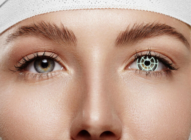 Chirurgie réfractive au laser : zoom sur la technique Lasik